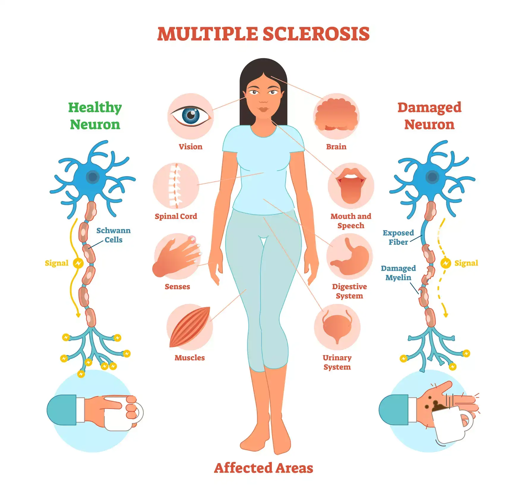 Multiple Sclerosis Symbols Quotes Ms Awareness Stock Illustrations