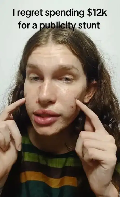 Cat-astrophic makeover: Woman regrets spending over ₹6 lakh on extreme ...