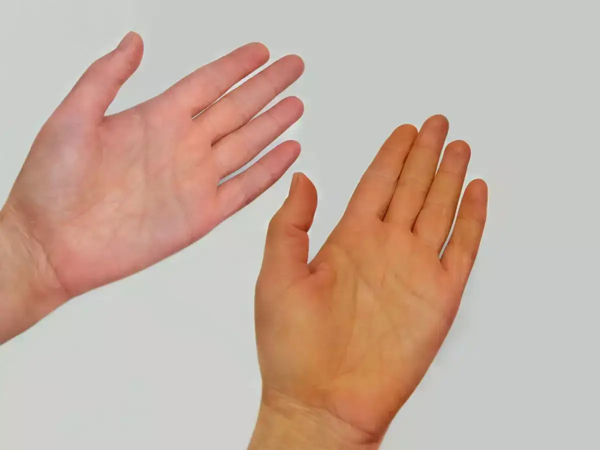 AIIMS doctor warns vegetarians of vitamin B12 deficiency: Symptoms ...