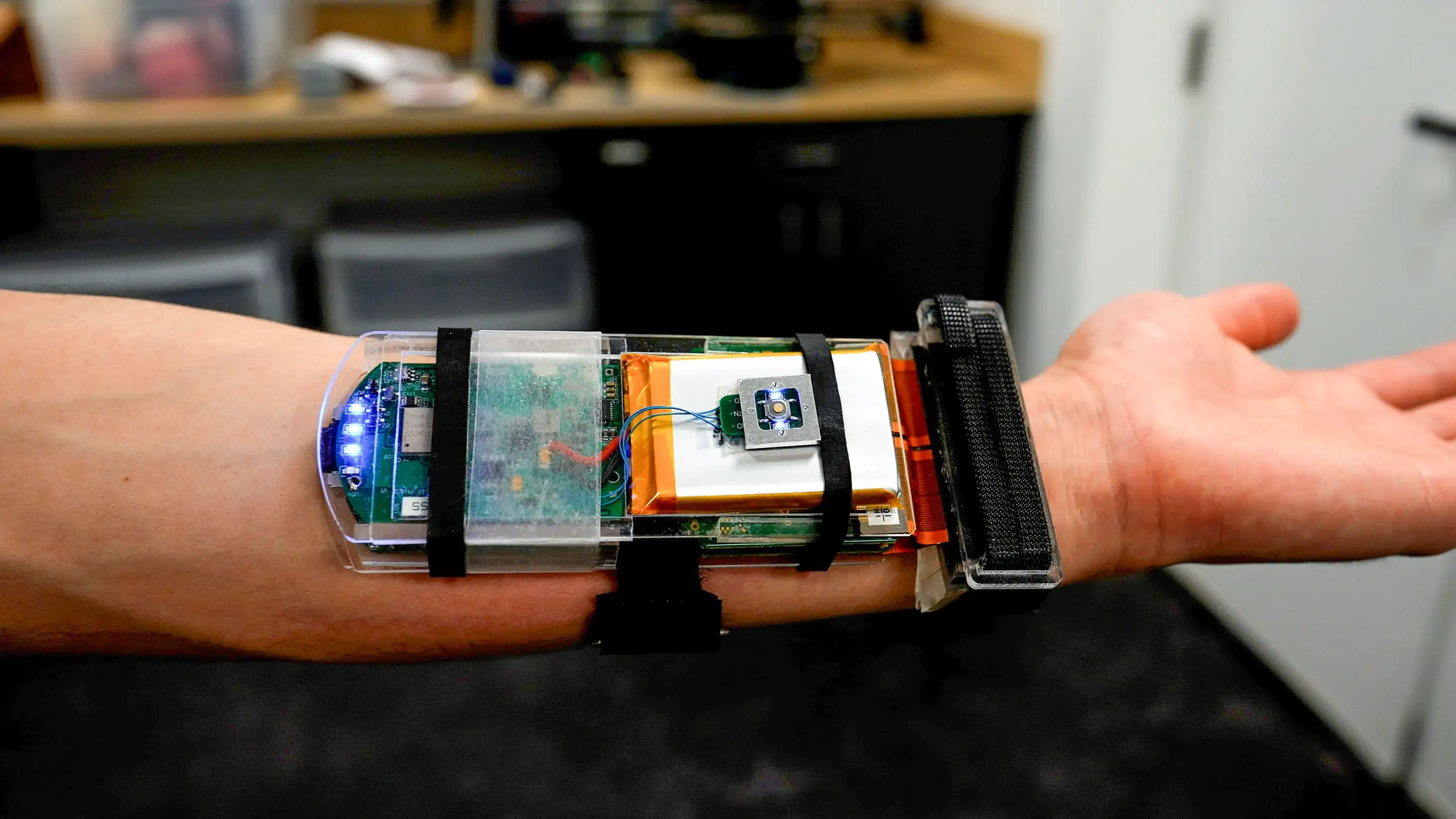 A wristband into a real-time hand reader, and the ultrasound system can ...