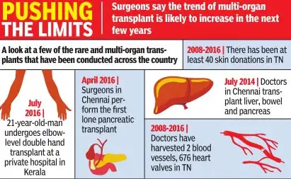 Mastering multi-organ transplants to save the critically ill - The ...