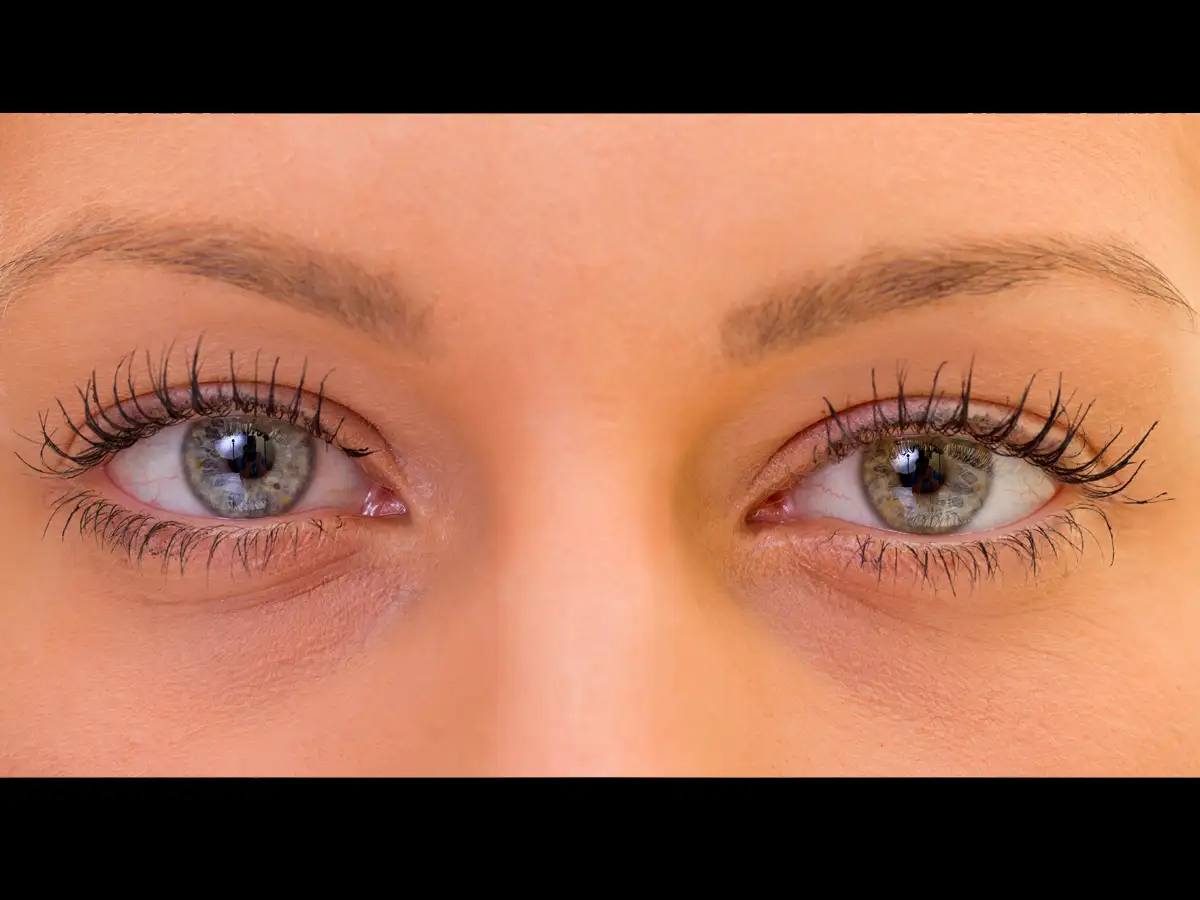 diabetic: Do you experience flashes of light, distortion of images ...