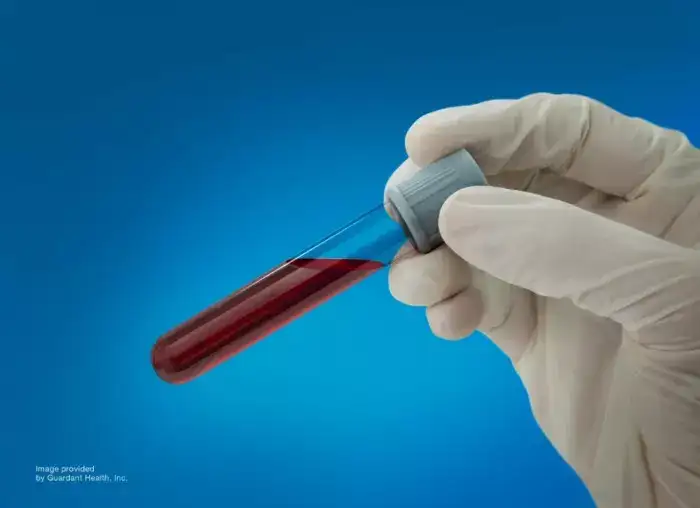 Guardant Health’s comprehensive liquid biopsy test, Guardant360®, helps ...