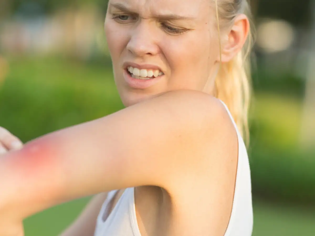 covid symptoms: Fever, chill & headache can be signs of either malaria ...