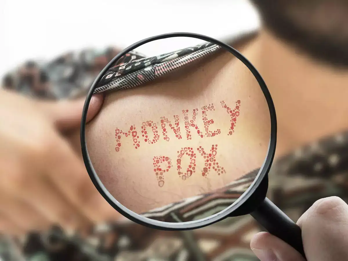 monkeypox symptoms: Rectal pain & penile swelling new symptoms of ...