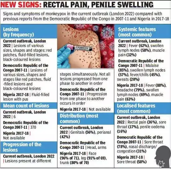 monkeypox symptoms: Rectal pain & penile swelling new symptoms of ...