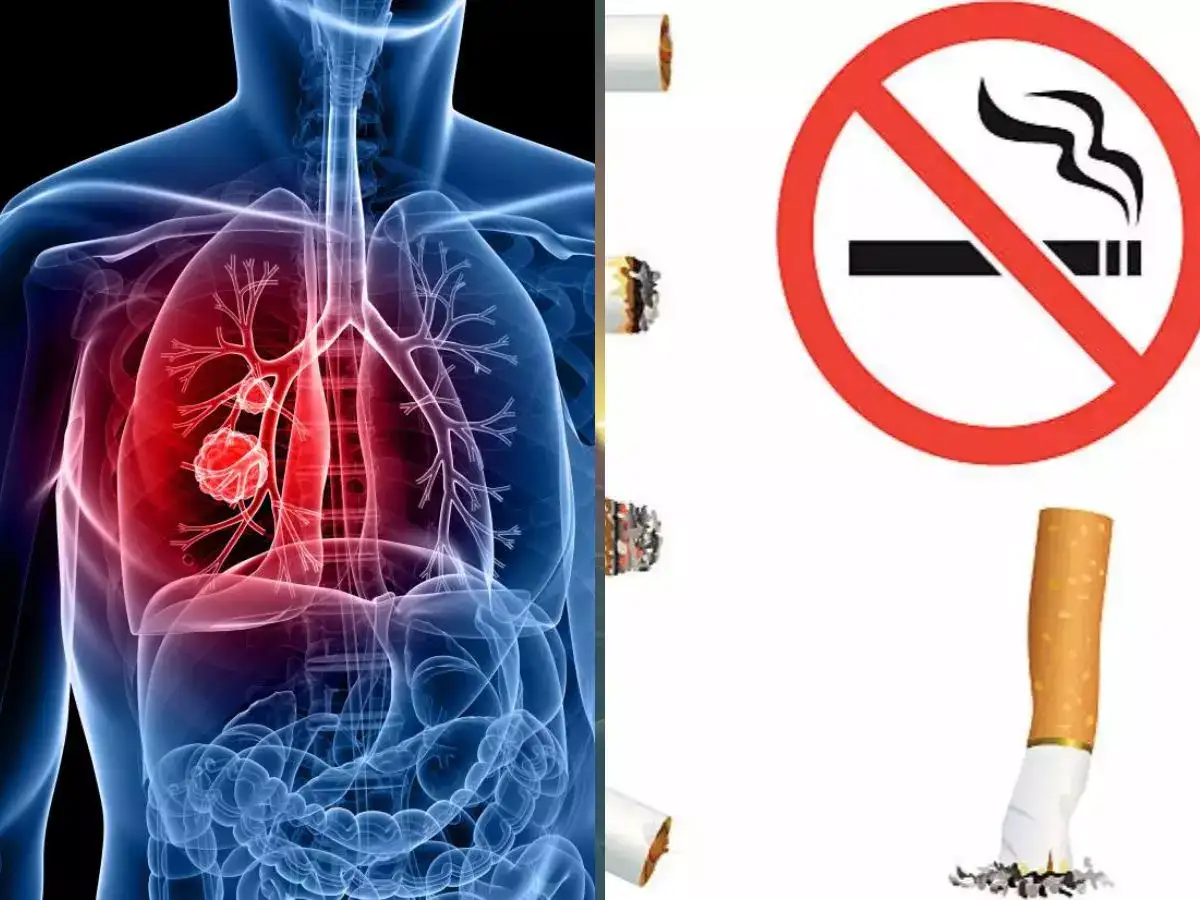 National Cancer Awareness Day: 5 common cancers in India; symptoms ...