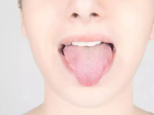 diet: Nature or nurture? Neuroscientists explain how our taste buds are ...