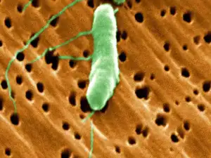 Flesh-Eating Bacteria: Rare flesh-eating bacteria vibrio vulnificus claims 3 lives in New York ...