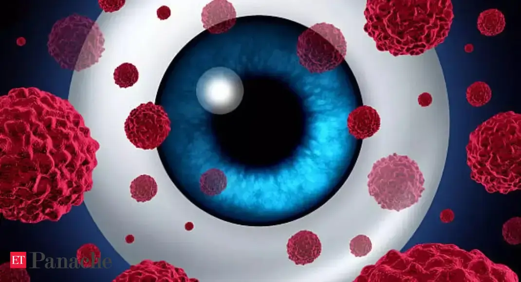 What Are Primary Eye Tumours - The Eyes Have It: 6 Eye Cancer Red Flags ...