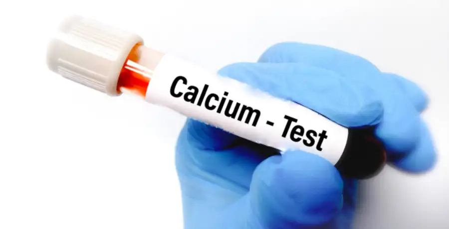 9 signs of calcium deficiency you shouldn't ignore | EconomicTimes