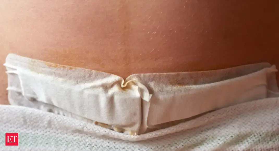 How your C-section scar can sometimes cause pain, itching, and smell ...