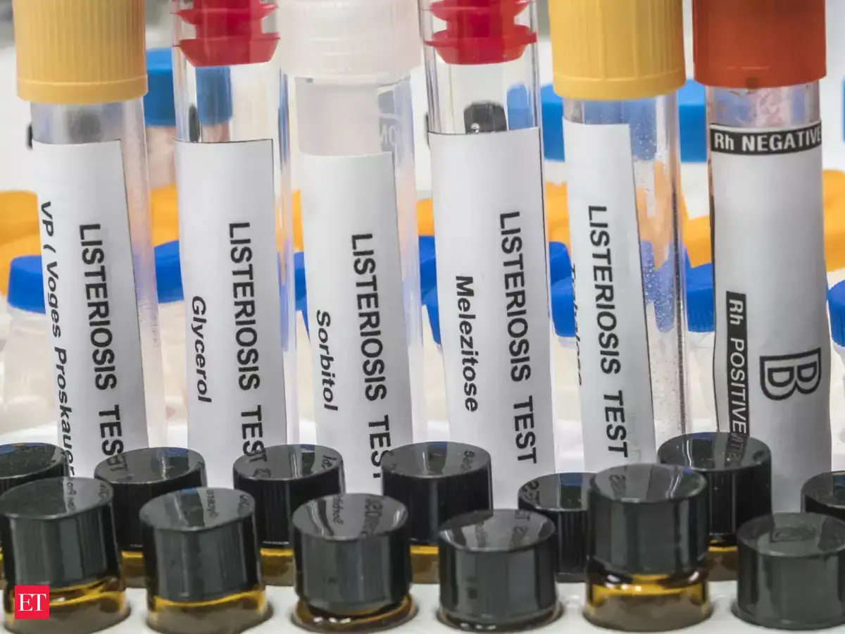 Listeria infection: Symptoms, source, and prevention - Overview of the ...
