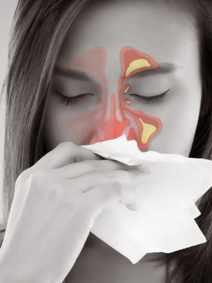 8 natural ways to relieve sinus congestion | EconomicTimes
