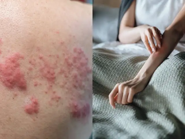 Kidney health alert: 6 early signs of kidney disease in legs and hands ...