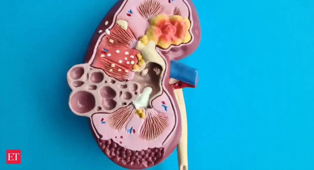 Kidney health alert: 6 early signs of kidney disease in legs and hands ...