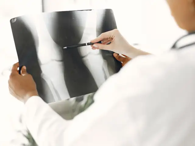 Doctors sound alarm on 'bone burnout' in the 30s: Here’s how to save ...