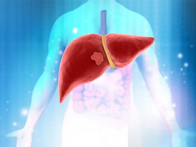 From turmeric to green tea: 5 "healthy" things that can turn dangerous ...