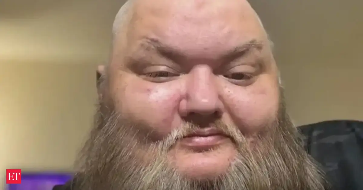 TikTok star KingBeardX dies at 47; What led to his sudden death? - The ...