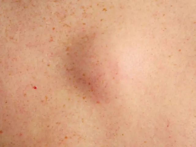 Watch out: 8 body changes in women that could signal cancer ...
