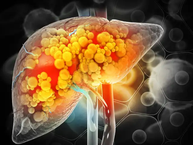 6 hidden health risks of drinking beer you shouldn’t ignore - The ...