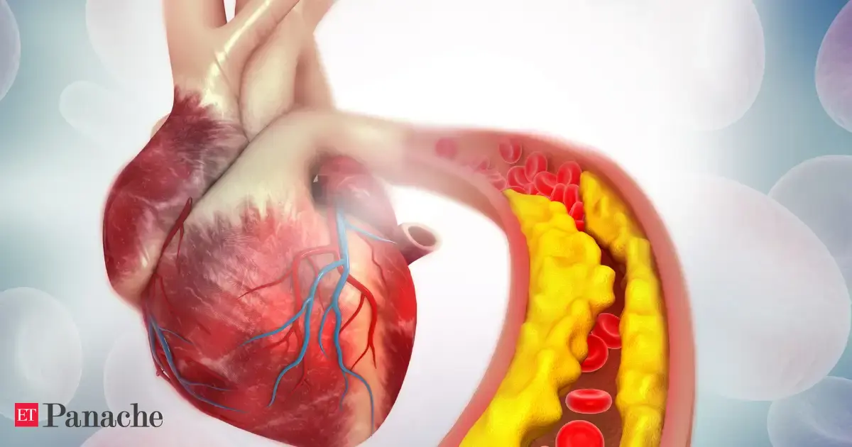 Your arteries may be lying to you: Cardiologist warns the most ...