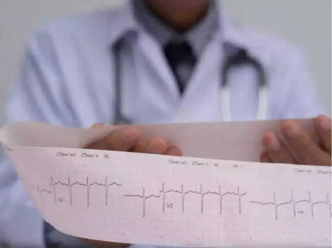 Celebrating a normal ECG report? Fortis doc reveals: ‘Normal ejection ...