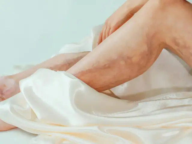 Common Skin Signs of Nutritional Deficiencies - Your Skin Tells a Story ...