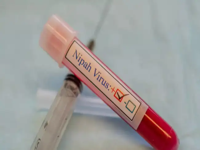 Nipah virus outbreak: Health ministry shares latest update on deadly ...