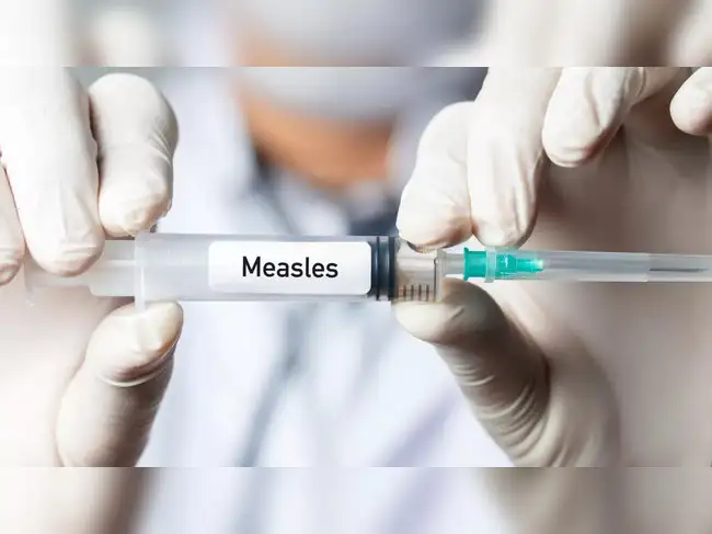 Potential Measles outbreak scare in California after over 100 children ...