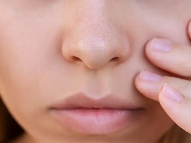 Sweat and build-up effect - Problem visible pores making skin look ...