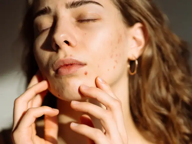 Still getting acne? These 7 simple fixes might be the real solution ...