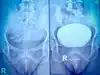 innovative bio labs steroids: Latest News & Videos, Photos about ...