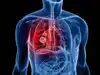 is the grail cancer test recommended by ohio health News and Updates ...
