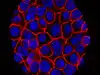 cervical cancer elimination australia: Latest News & Videos, Photos ...