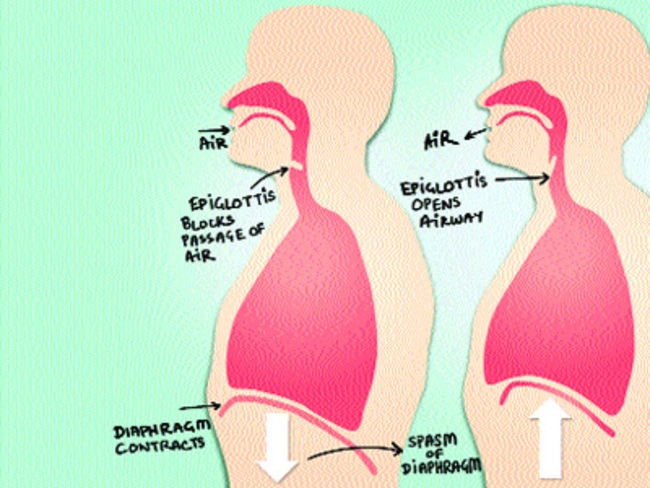 Hiccups: How it works - The Economic Times