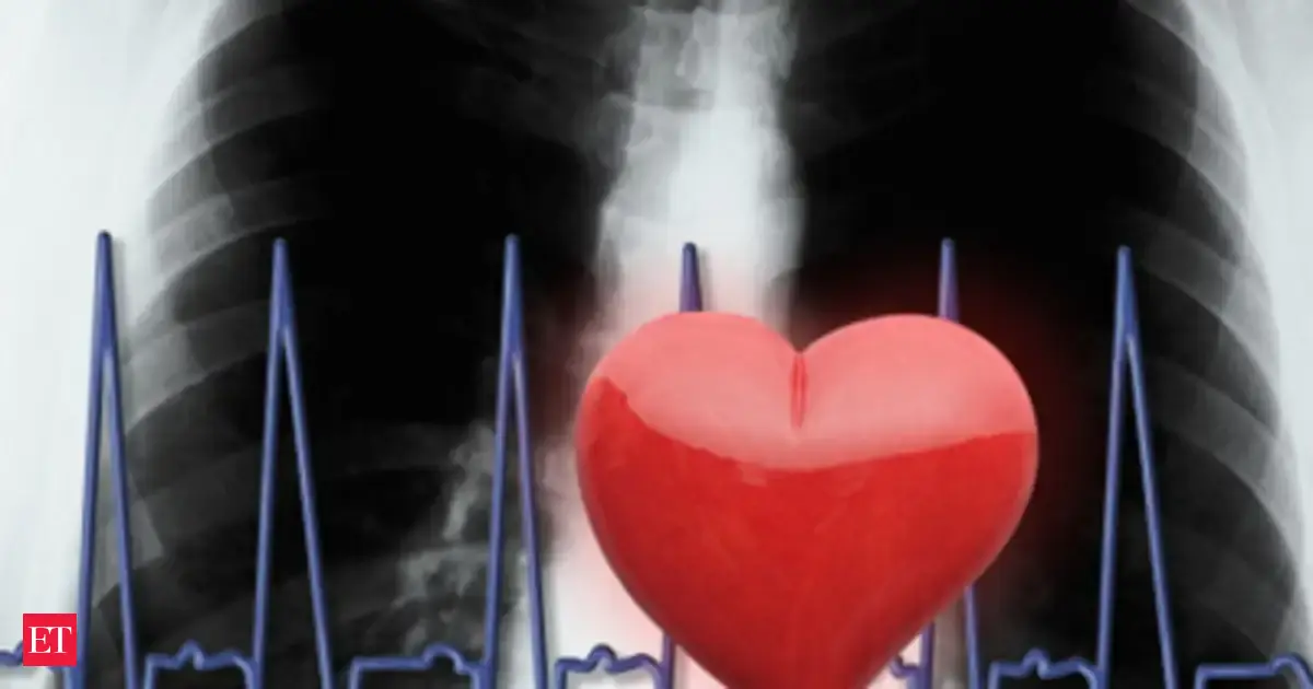 Now, smartphone app to predict heart attack risk - The Economic Times