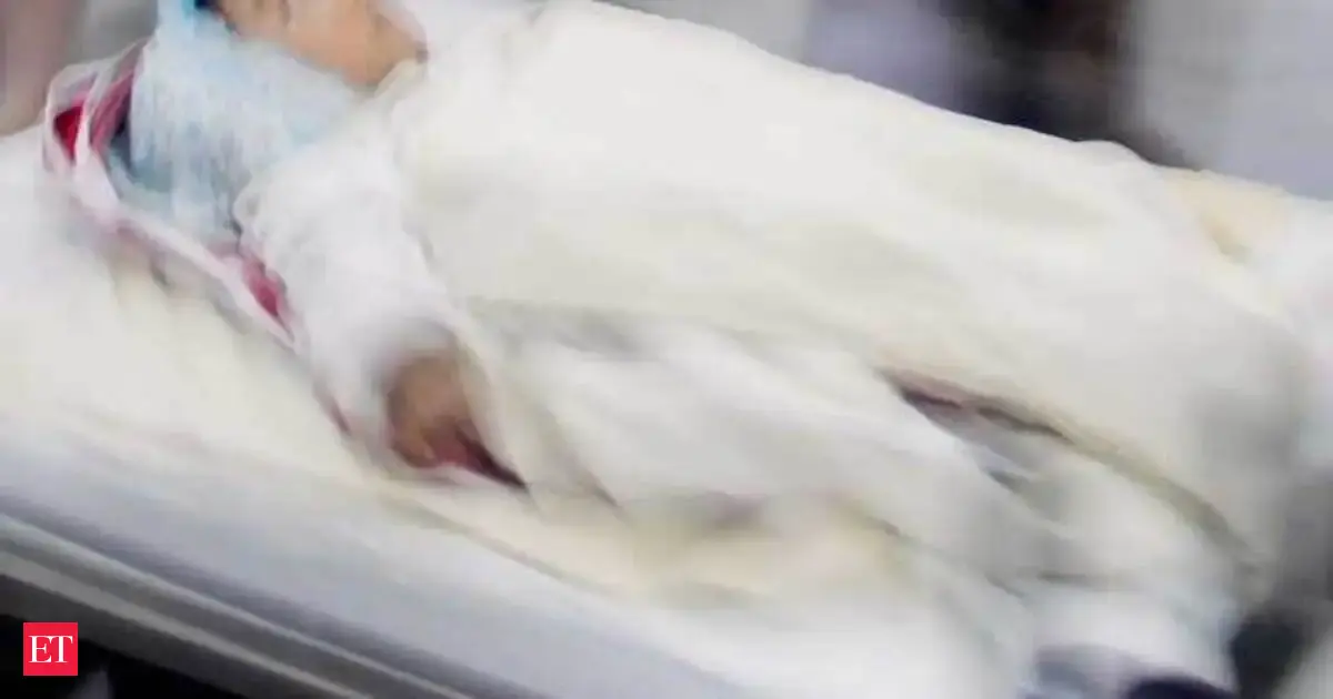 Low cost inflatable baby incubator developed - The Economic Times