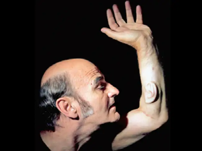 Australian artist to connect ear grown on arm to internet! - The ...