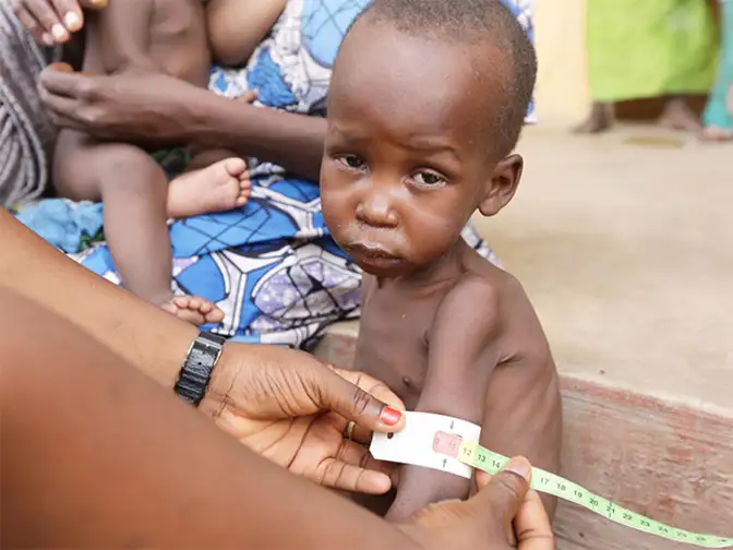 India has most number of stunted children in world: Study - The ...