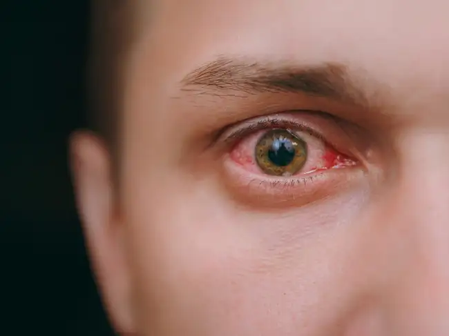 diabetic: Do you experience flashes of light, distortion of images ...