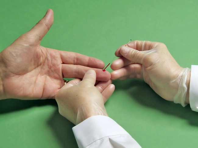 health problems: Say goodbye to painful needle pricks: Wearable sweat ...