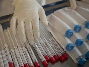 Global companies extend a hand with 1 million Covid-19 test kits - The ...