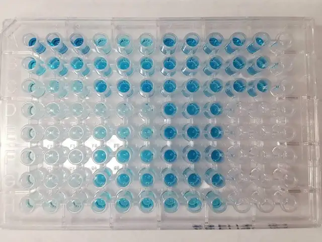 How it works - Covid-19: What is ELISA-based antibody test? | The ...