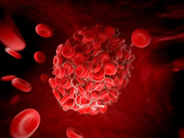 Post-mortem findings of Covid-19 patients reveal extensive damage to ...