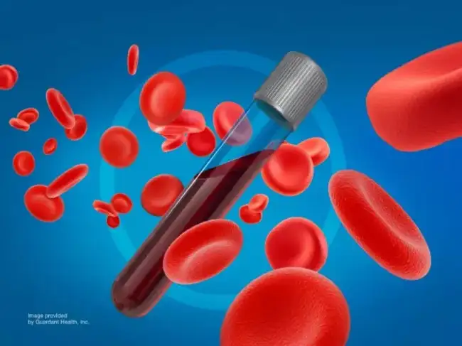 Guardant Health’s comprehensive liquid biopsy test, Guardant360®, helps ...