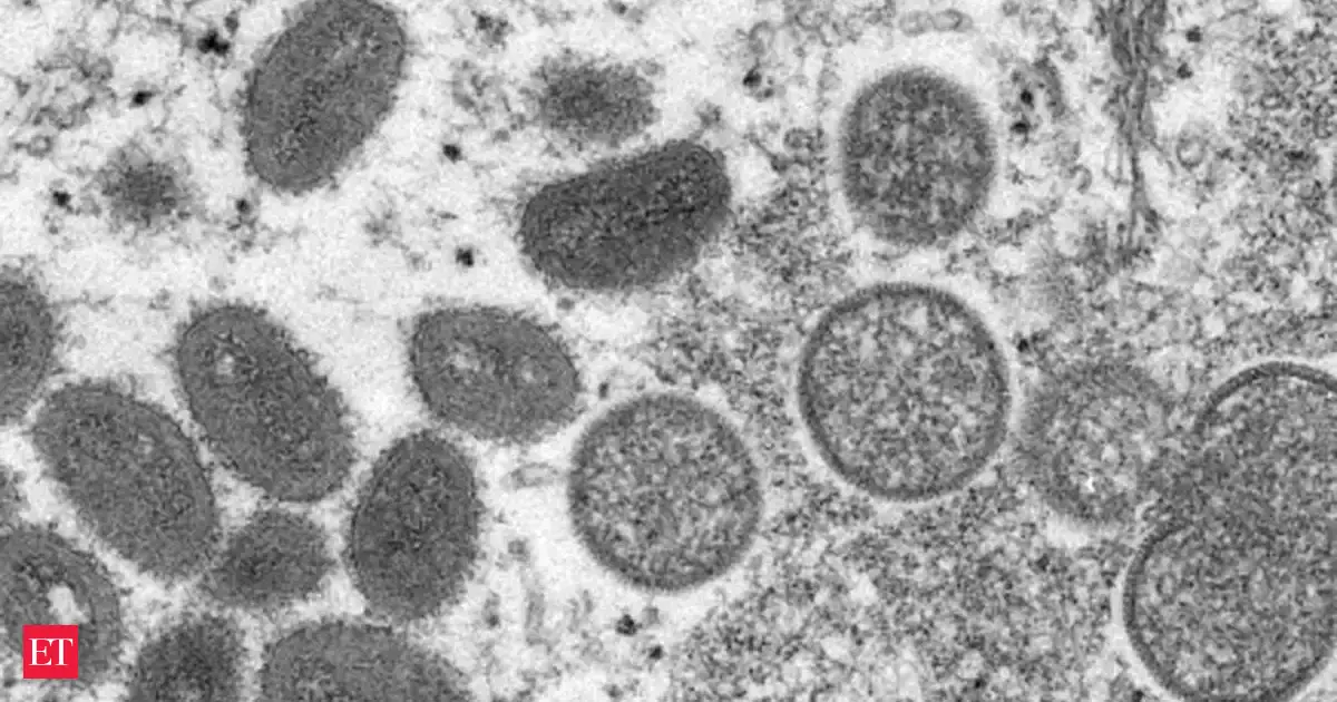 Europe monkeypox: Europe 'epicentre' of monkeypox outbreak: WHO - The ...