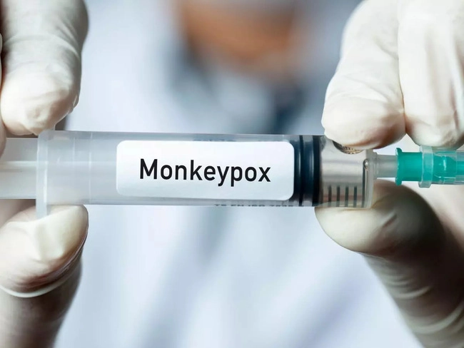 Monkeypox health emergency explained. A look at protective measures ...