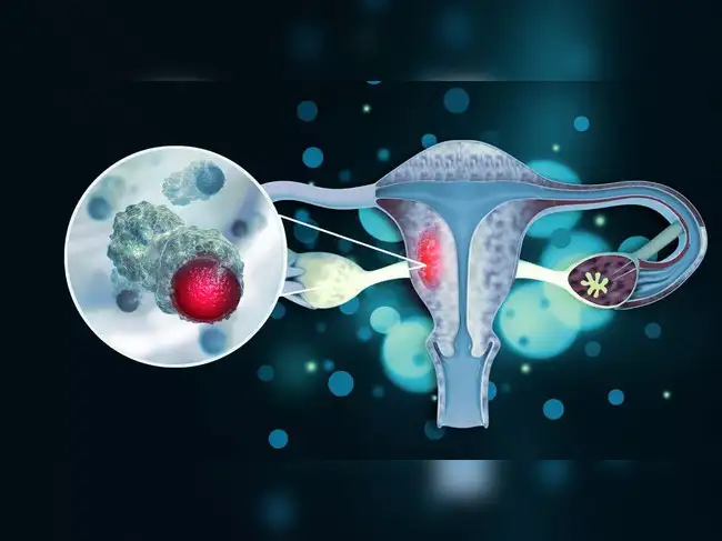 cervical cancer: 'Made in India' Cervical Cancer vaccine ready: Know ...
