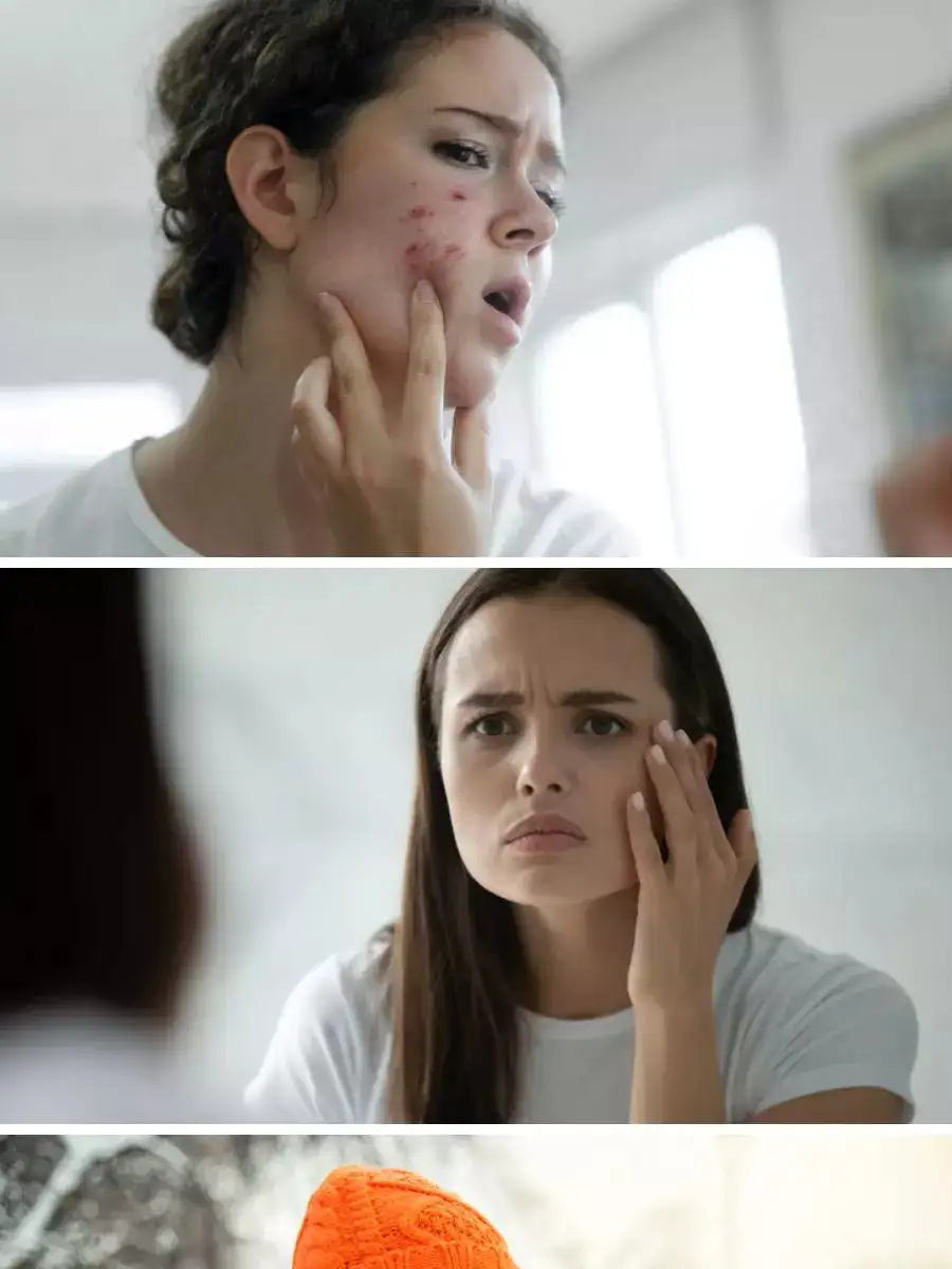 Winter Skin Care: Dry Skin & Chapped Lips? Tips To Prep Your Skin For ...